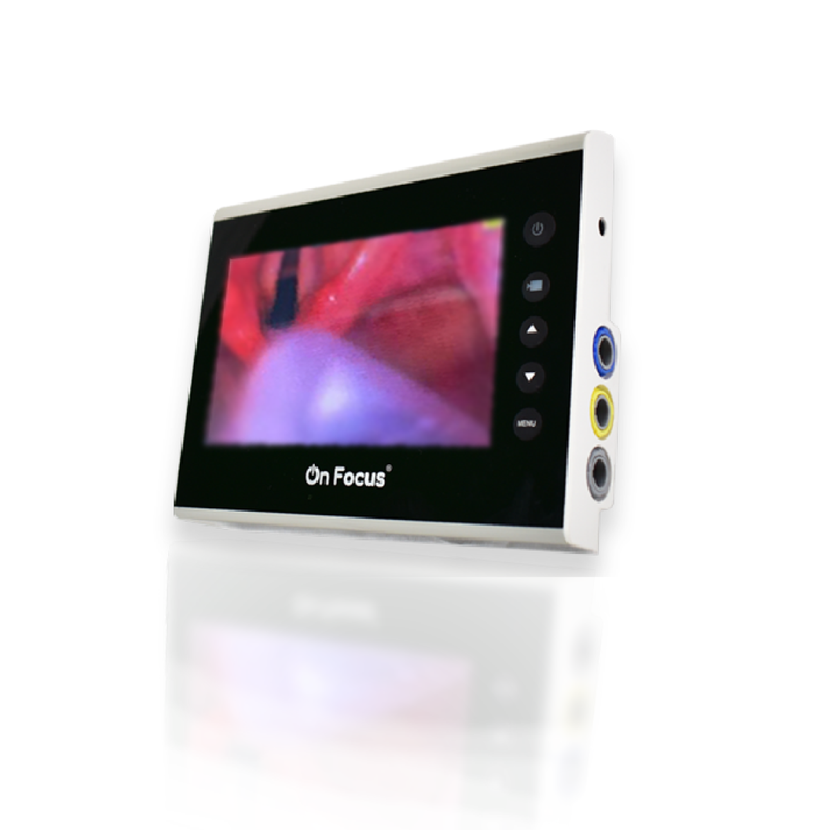 Videolarigoscopio OnFocus